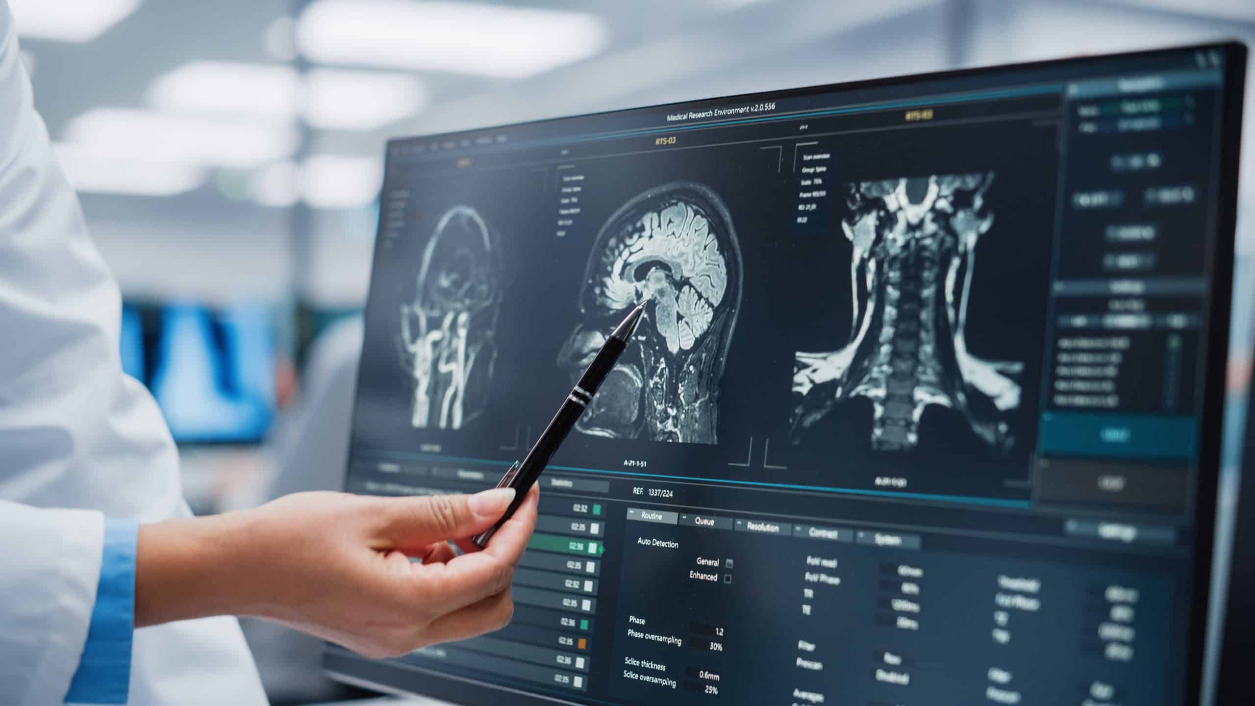 Navigating the Complex Terrain of Traumatic Brain Injuries ... Navigating the Complex Terrain of Traumatic Brain Injuries ...